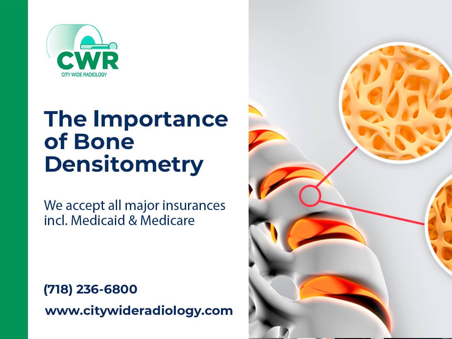 Advanced Bone Density Scan in Brooklyn, NY | City Wide Radiology